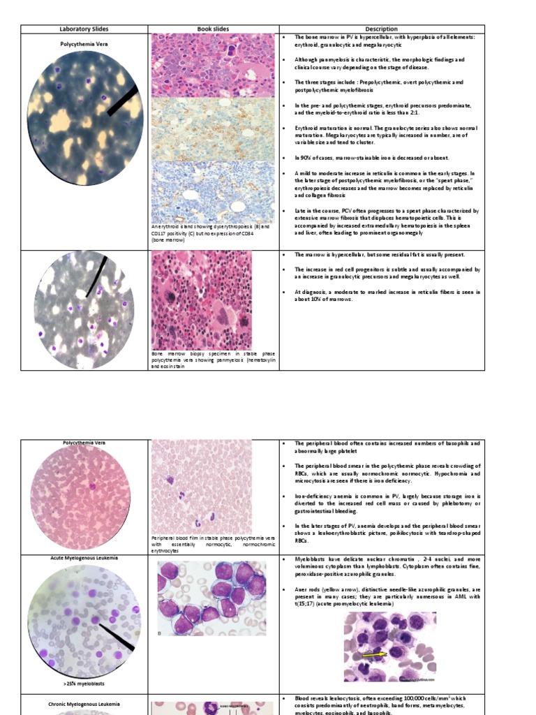 Laboratory Slides Book Slides Description: Polycythemia Vera | PDF ...