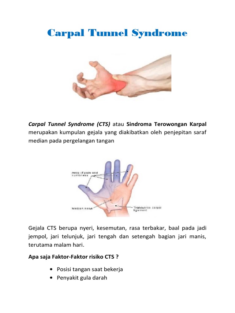 Edukasi Carpal Tunnel Syndrome | PDF