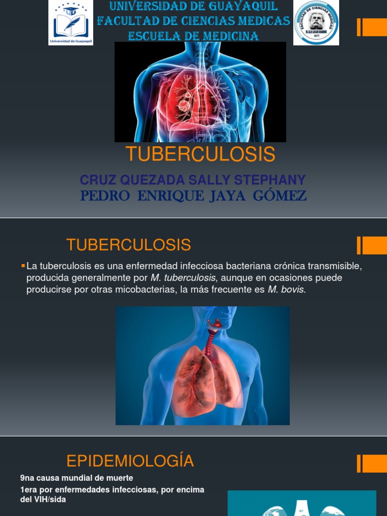 Tuberculosis | PDF | Tuberculosis | Salud pública