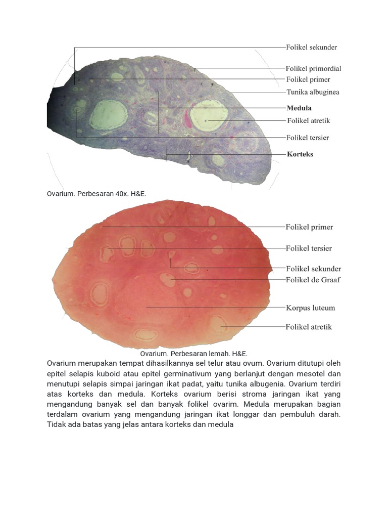 Folikel Primordial, Folikel Sekunder, dan Folikel Atretik Ovarium ...