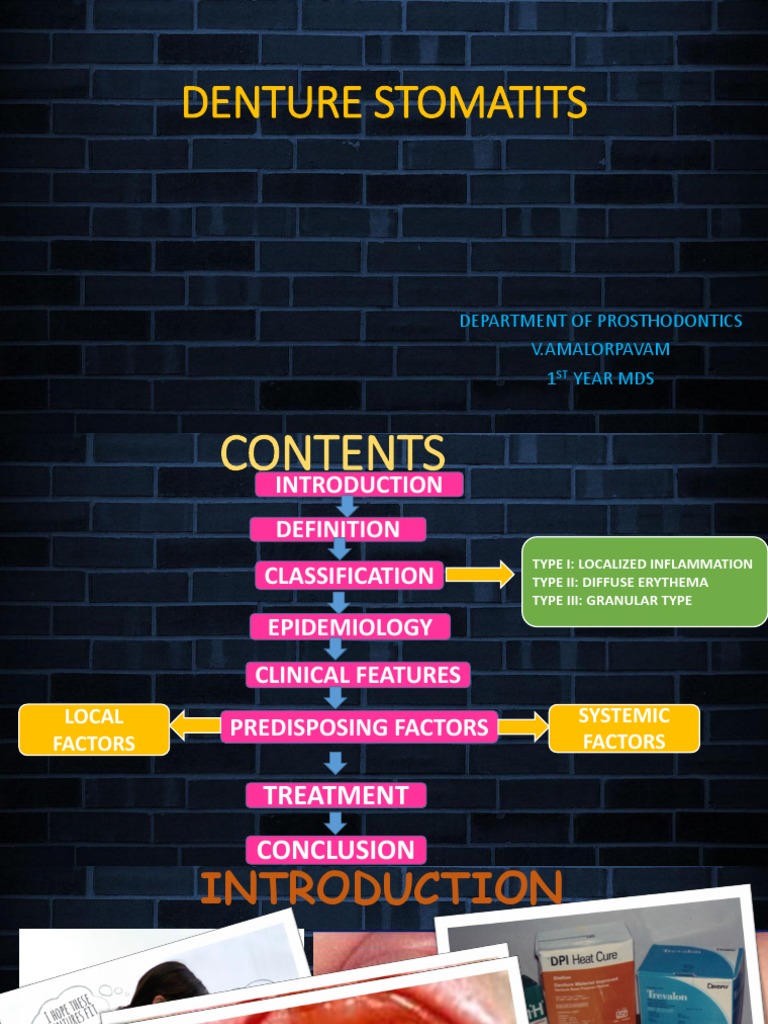 Denture Stomatitis | PDF | Candidiasis | Dentures