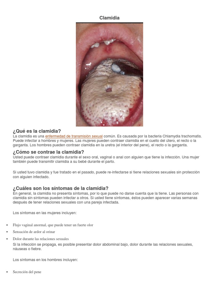 Clamidia | Herpes Simple | Infección transmitida sexualmente