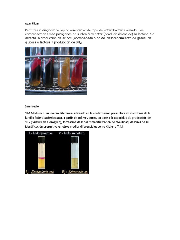 practica 9 uacj enterobacterias pruebas bioquimicas.docx | Amoníaco ...