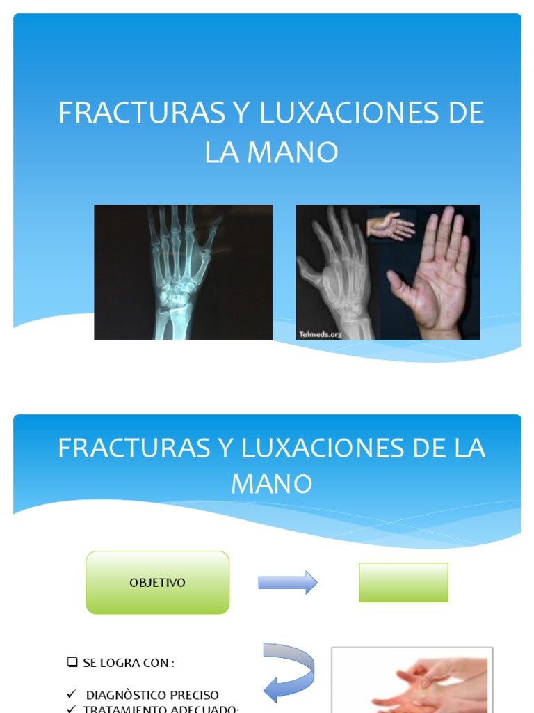 Fracturas y Luxaciones de la Mano | PDF | Sistema musculoesquelético ...