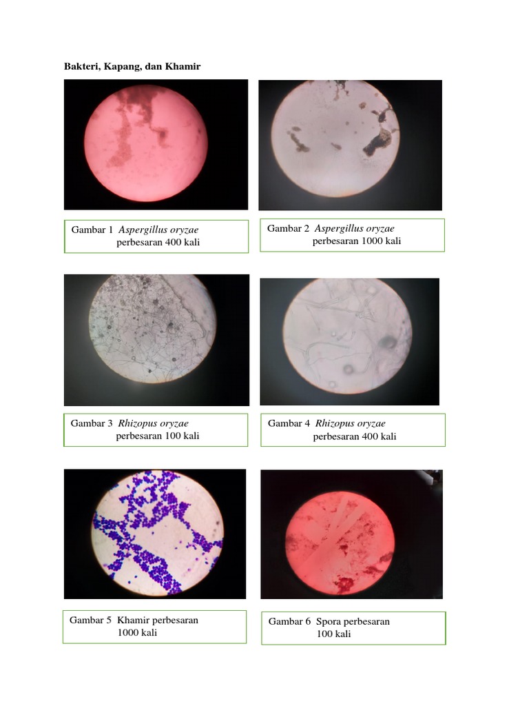 Sekilas Data Pengamatan Mikroskop Kapang Khamir | PDF