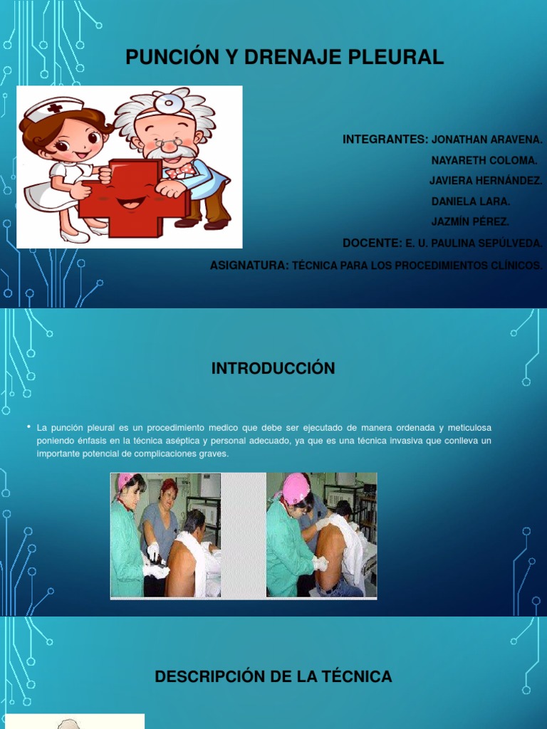 Procedimientos de drenaje pleural y punción pleural: técnica ...