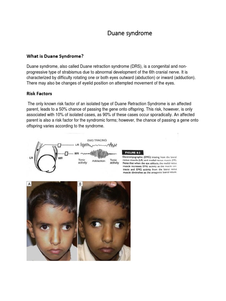 Duane Syndrome | PDF | Diseases Of The Eye And Adnexa | Ophthalmology