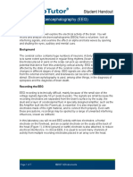 SREDA (Subclinical Rhythmic Electrographic Discharges in Adults ...