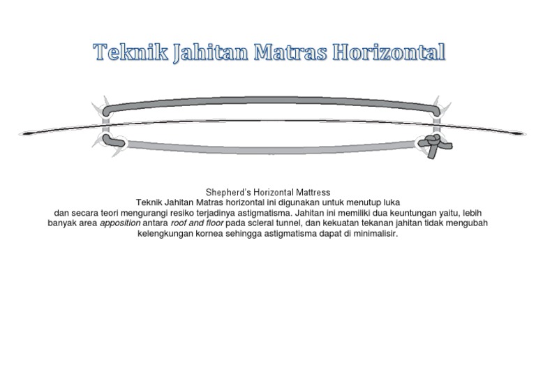 Teknik Jahitan Matras Horizontal Digunakan Untuk Menutup Luka | PDF