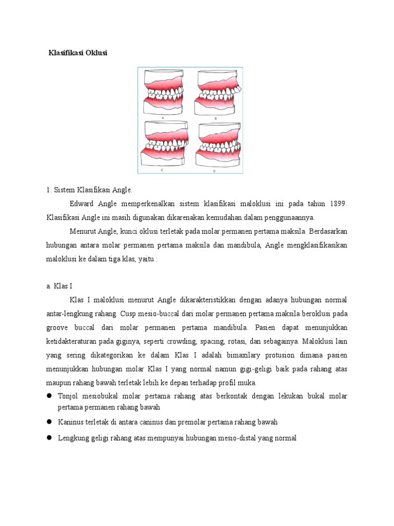 Klasifikasi Oklusi | PDF | Ilmu Sosial