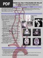 Pitch y TC Helicoidal | PDF | Ct Scan