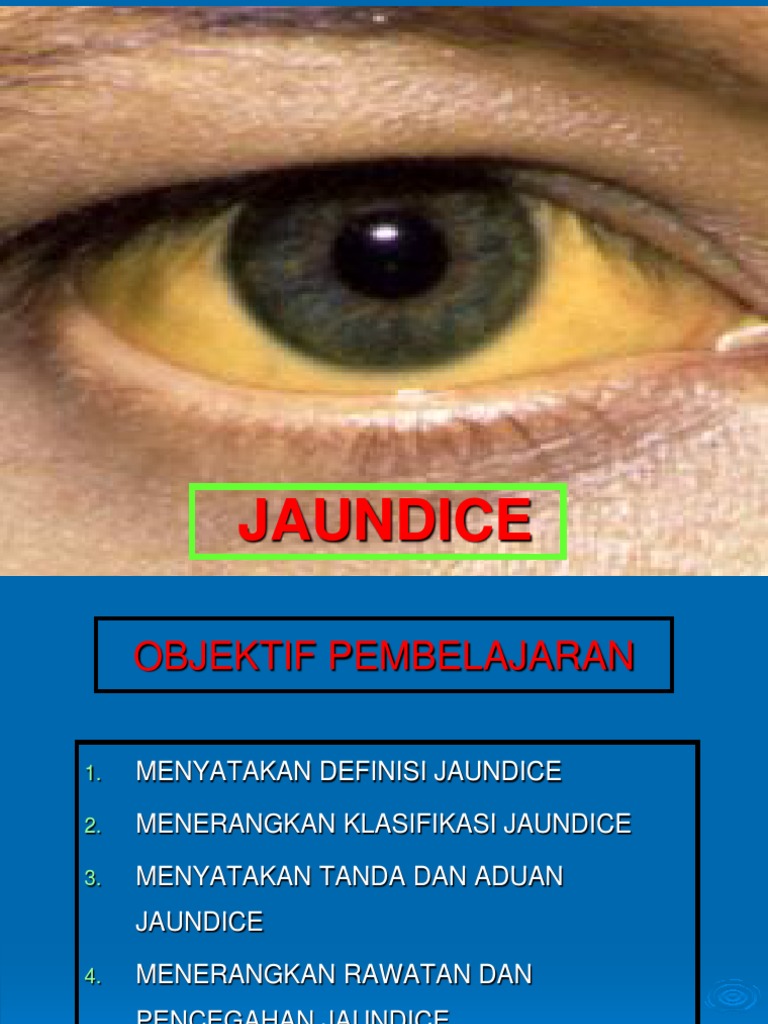 Jaundice | PDF | Animal Anatomy | Digestive System