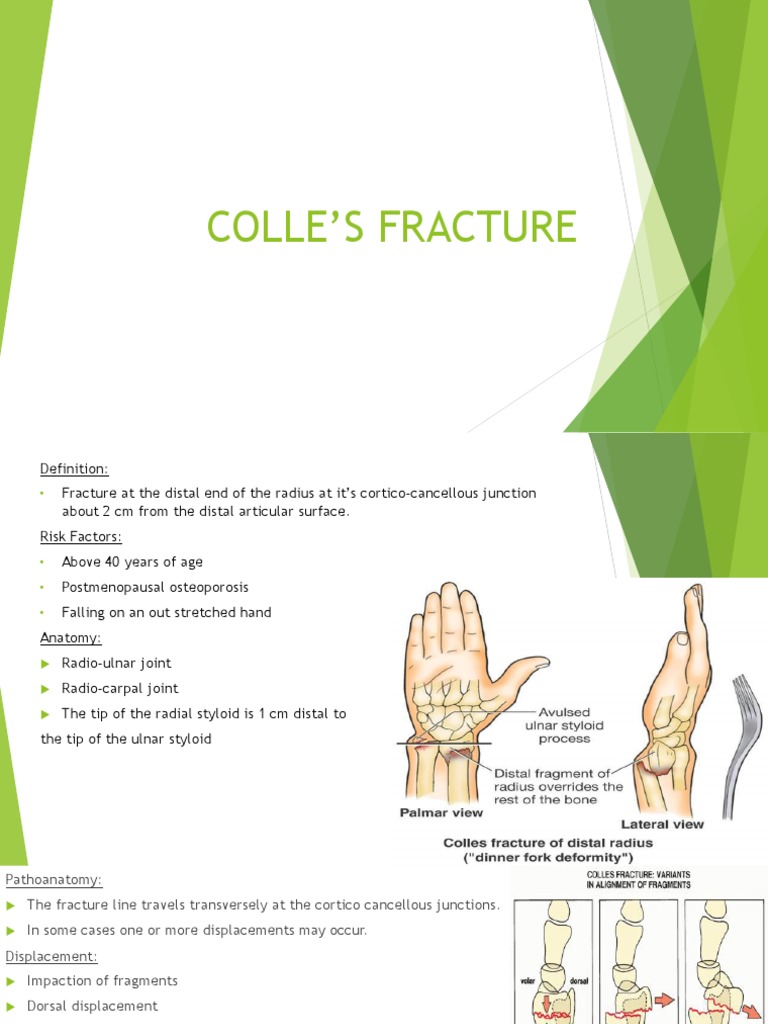 Colle's Fracture | PDF | Elbow | Hand