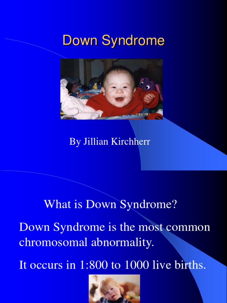 Understanding Down Syndrome: Causes & Effects | PDF
