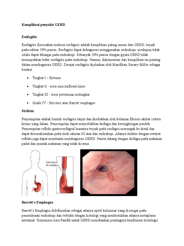 Komplikasi Gerd | PDF