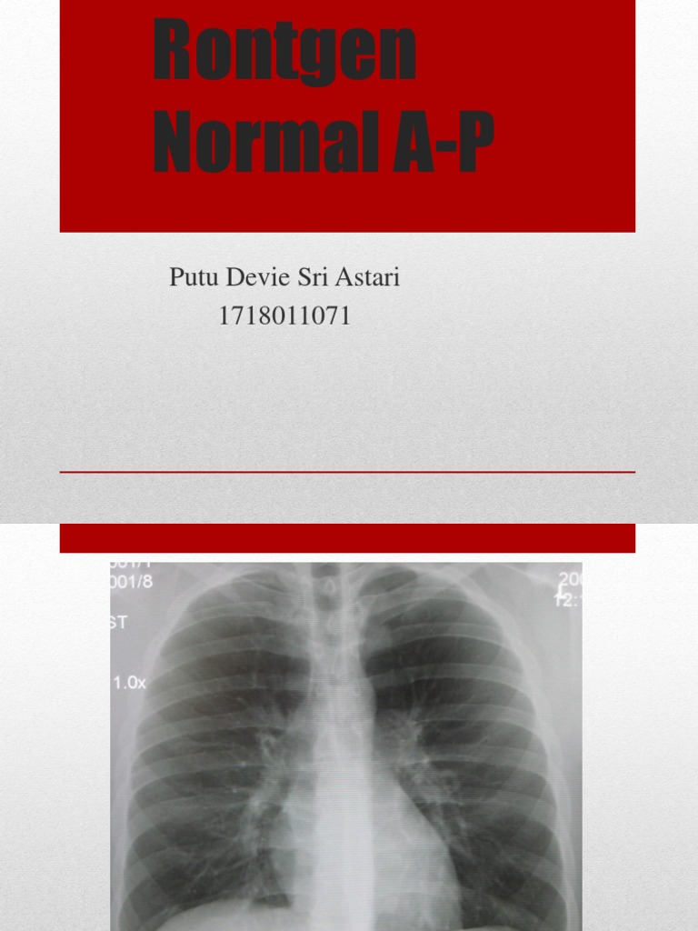 CSL Rotgen Thorax AP | PDF