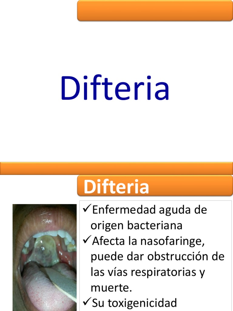 Difteria | PDF | Inmunología | Salud pública