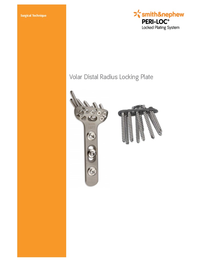 Peri-Loc Volar Distal Radius Locking Plate ST PDF | PDF | Screw | Drill