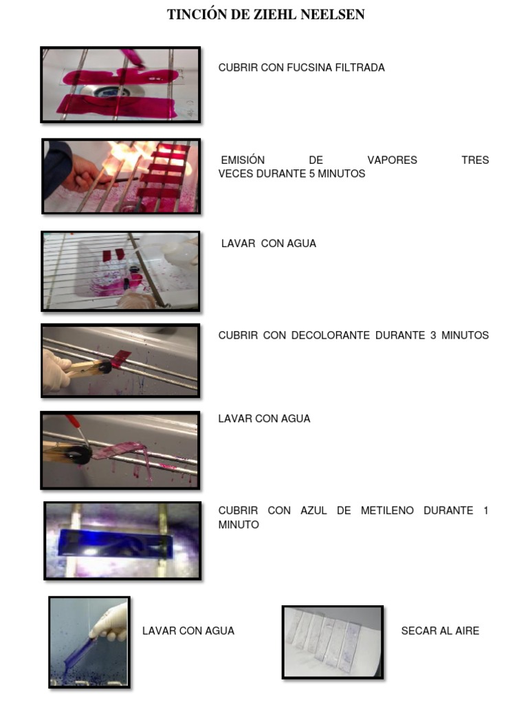 Tinción de Ziehl Neelsen | PDF | Técnicas de laboratorio. | Polímeros