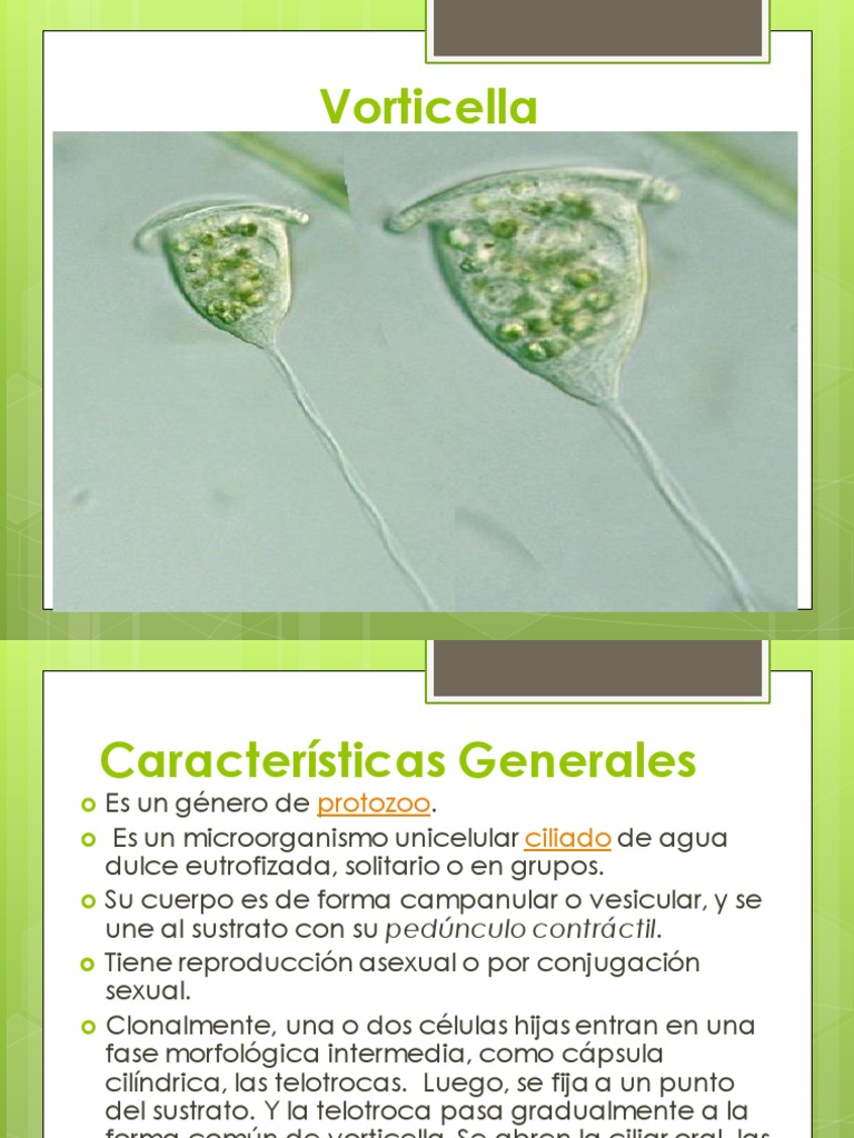 Vorticella | Biología Celular) | Biología