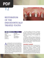 Post-Dam in Complete Dentures | PDF | Dentures | Nature