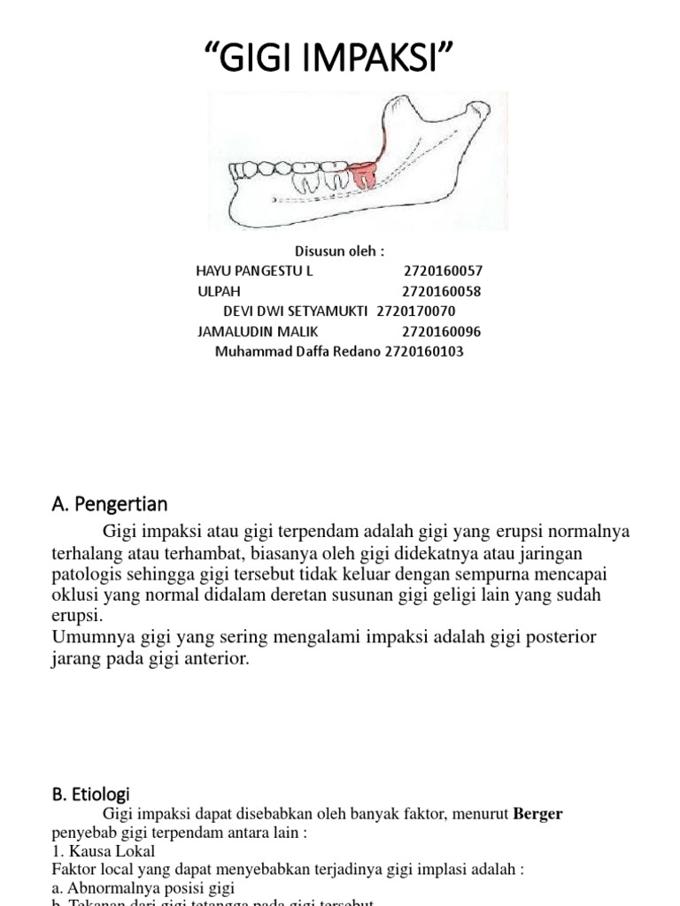 Gigi Impaksi | PDF | Sains & Matematika