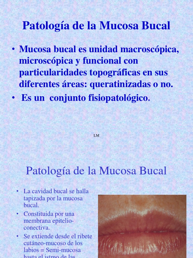 Patología de La Mucosa Bucal PDF | PDF | Epitelio | Membrana mucosa
