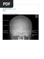 Brain MRI Protocols and Planning Guide | PDF | Magnetic Resonance ...