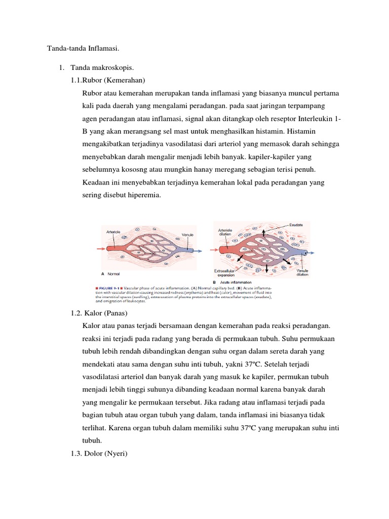 Tanda-Tanda Makroskopis Inflamasi | PDF