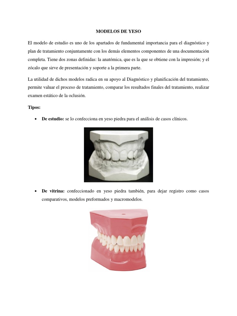 Modelos de Yeso y Zócalos | Dentadura postiza | Yeso