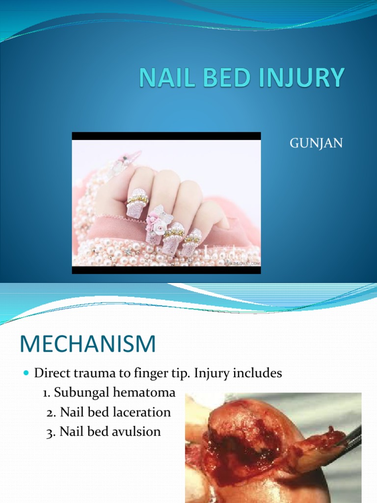 Nail Bed Injury | PDF | Nail (Anatomy) | Finger