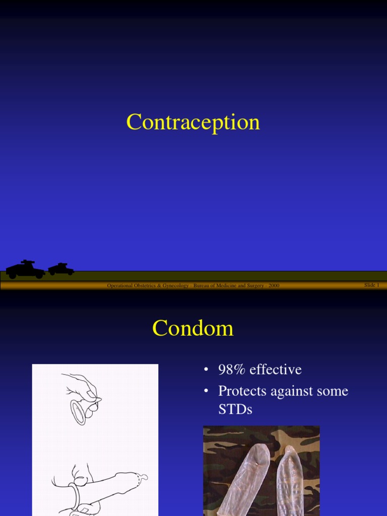Contraception: Operational Obstetrics & Gynecology Bureau of Medicine ...