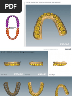 Hotkeys - Exocad | PDF | Cursor (User Interface) | Keyboard Shortcut