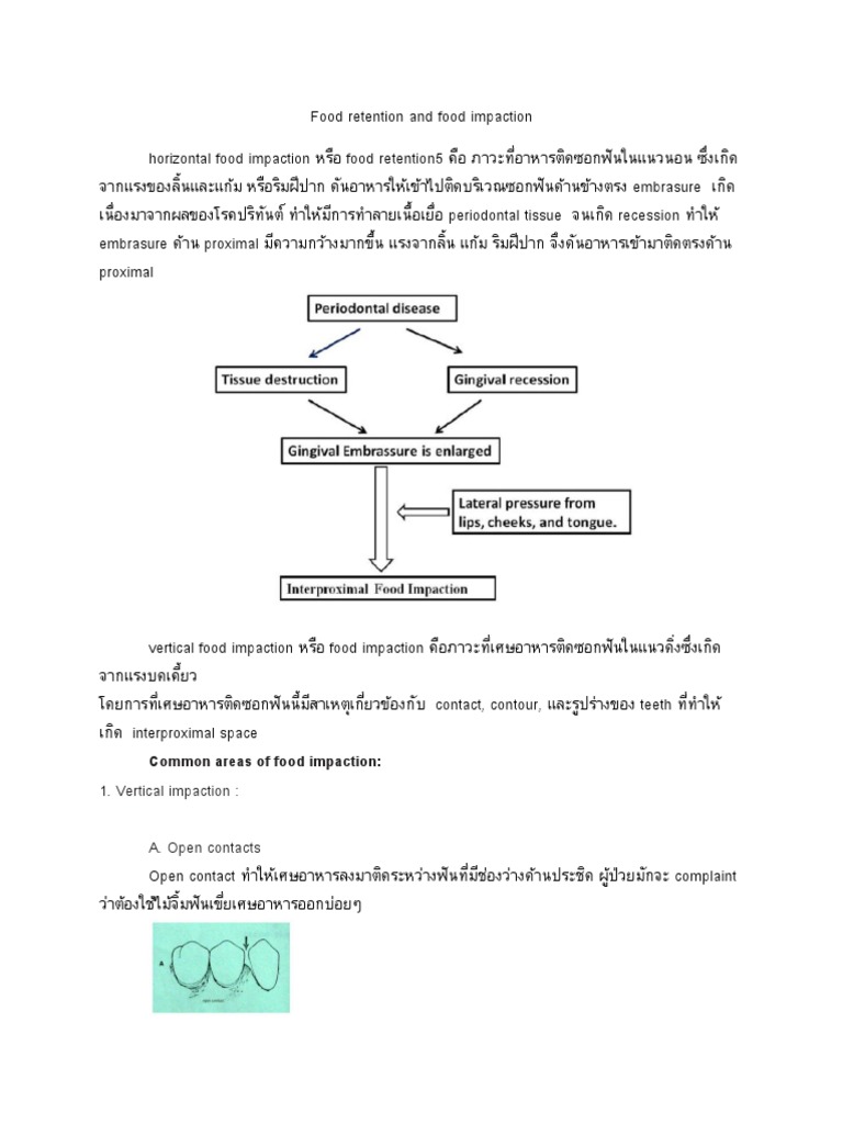 Food Retention and Food Impaction | PDF