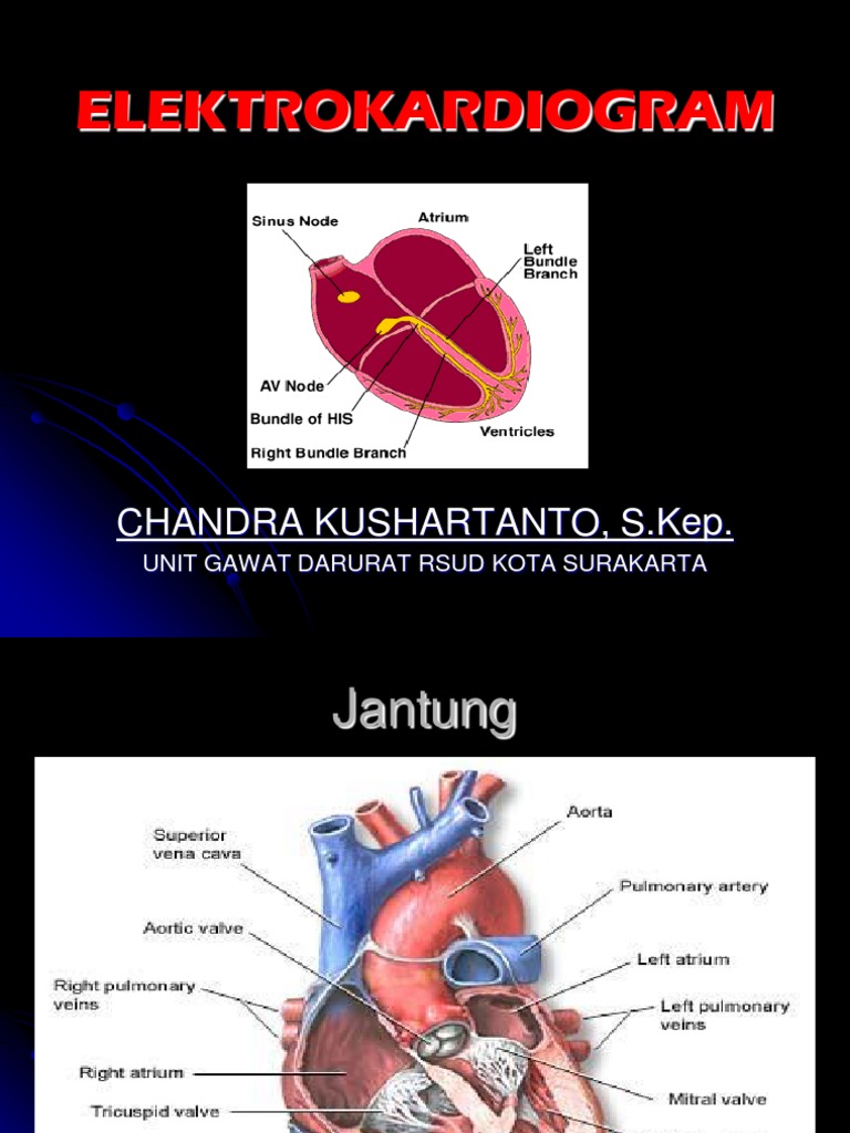 Elektrokardiogram PDF | PDF