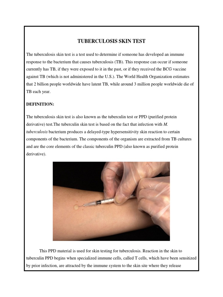 Tuberculin Skin Test | PDF | Medical Specialties | Clinical Medicine