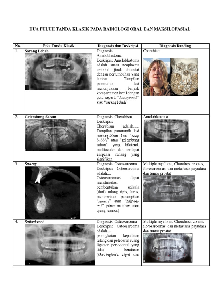 20 Tanda Klasik Pada Radiografi Oral Dan Maksilofasial | PDF