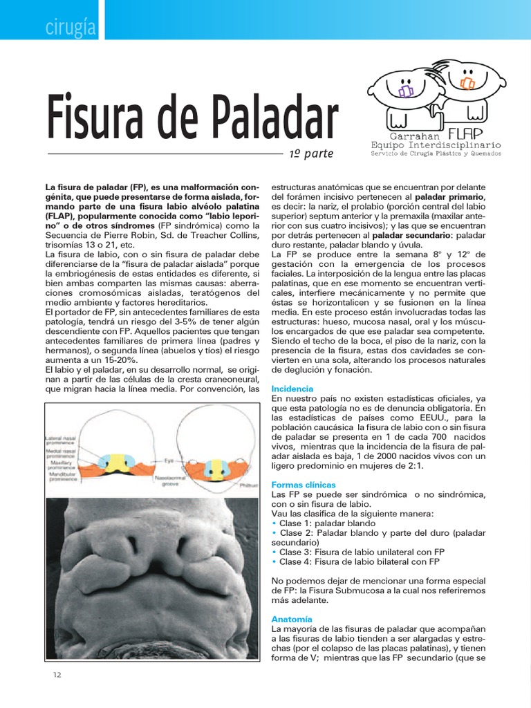 Fisura Paladar 1 | PDF | Ortodoncia | Anatomia animal