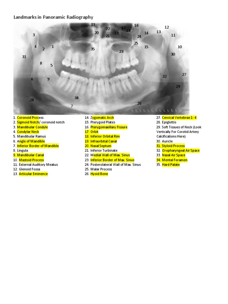Landmarks in Panoramic Radiography | PDF | Human Nose | Human Anatomy