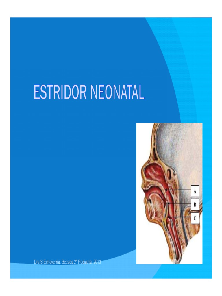 Estridor Neonatal PDF | PDF | Tos | Otorrinolaringología