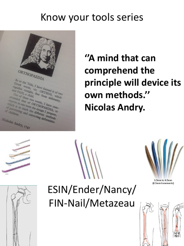 Know your tools: Flexible intramedullary nailing (FIN | PDF ...