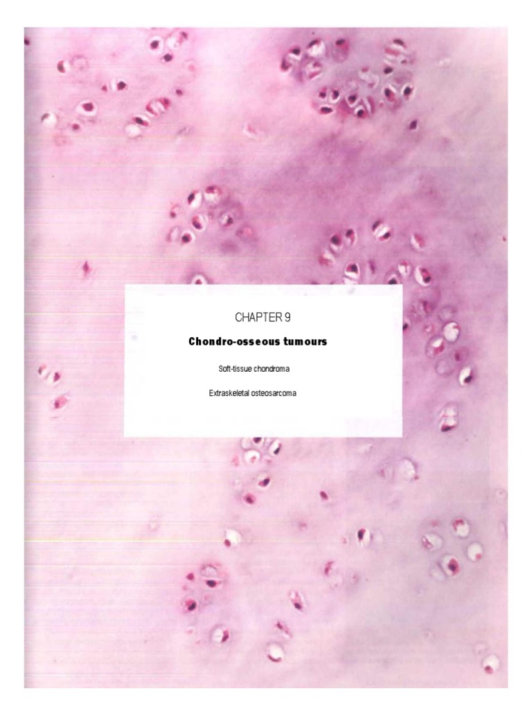 Chondro-Osseous Tumours: Soft-Tissue Chondroma Extraskeletal ...