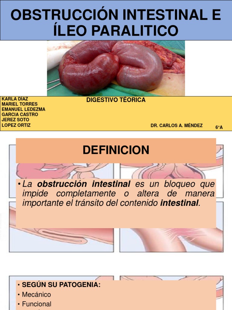 Obstrucción Intestinal e Íleo Paralitico | PDF | Especialidades Medicas ...