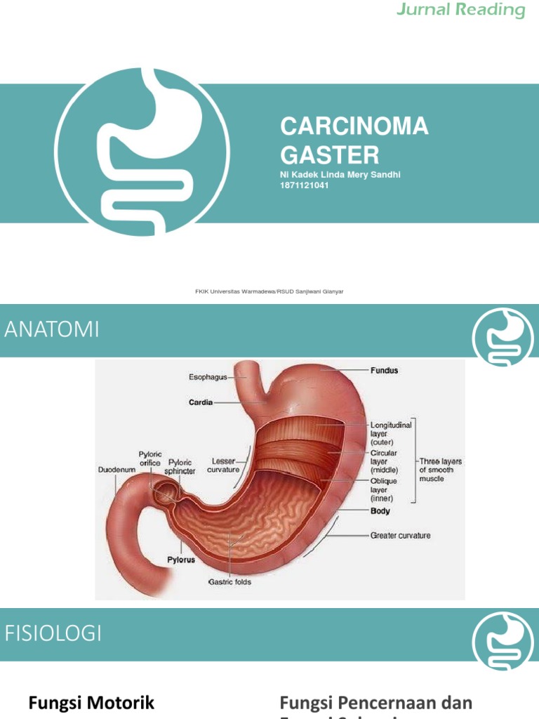 Ca Gaster | PDF | Metastasis | Digestive Diseases
