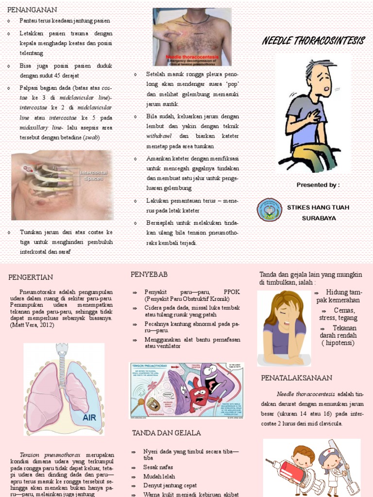 Leaflet Pneumothorax Fix PDF | PDF
