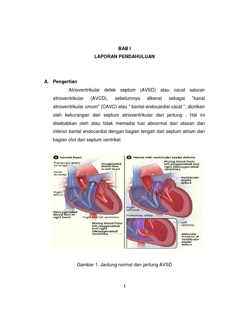 Asuhan Keperawatan Atrioventrikuler Canal Defect (AVSD) | PDF
