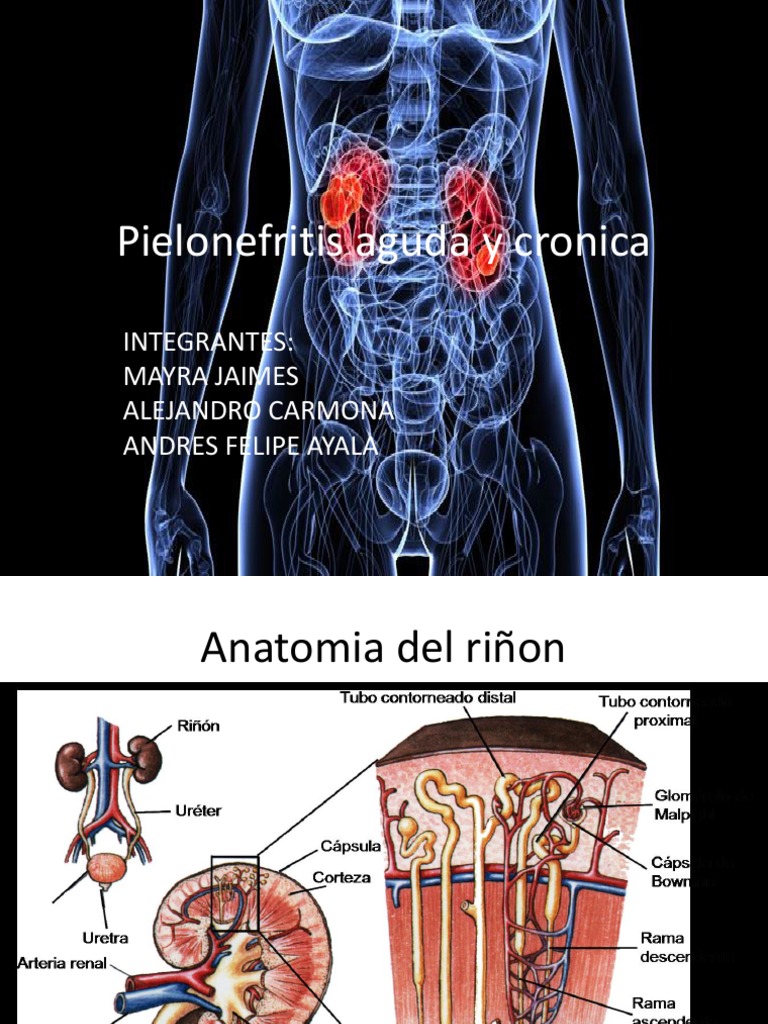 Pielonefritis Aguda y Cronica | PDF | Órgano (anatomía) | Urología