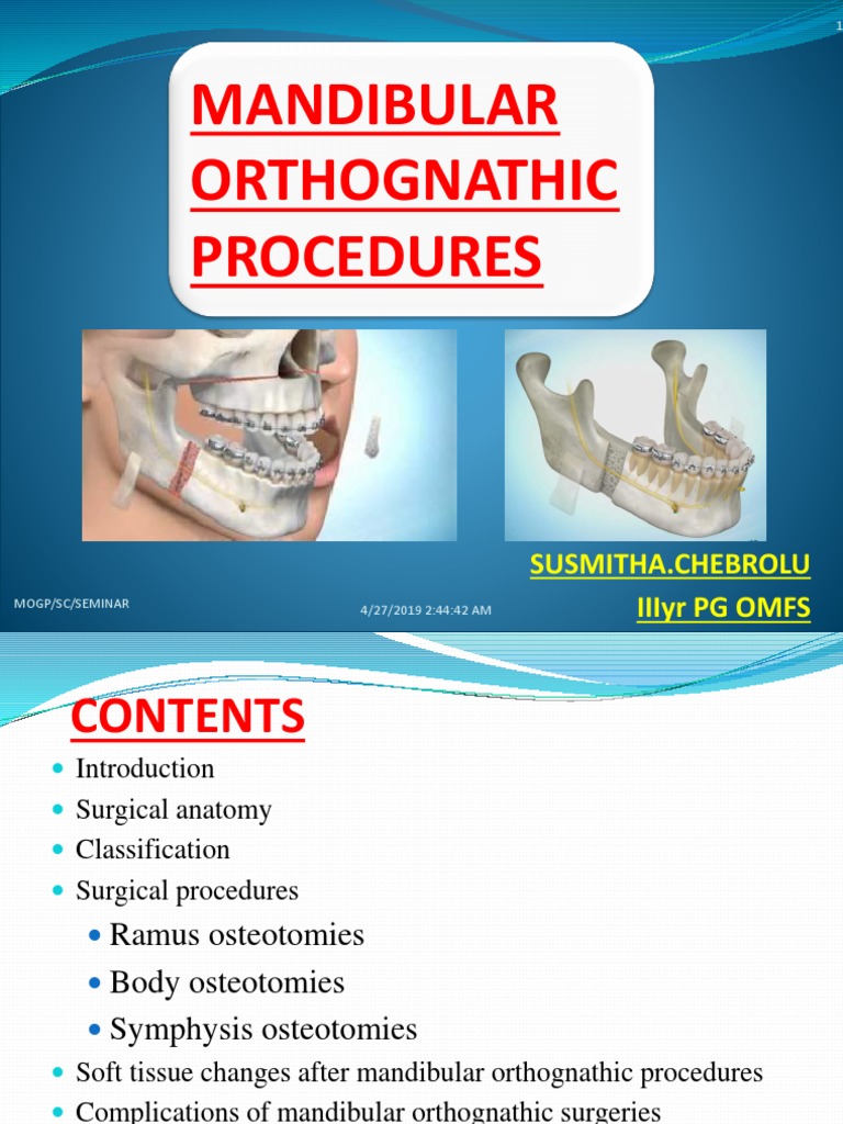 Mandibular Orthognathic Surgery Overview | PDF | Orthodontics ...