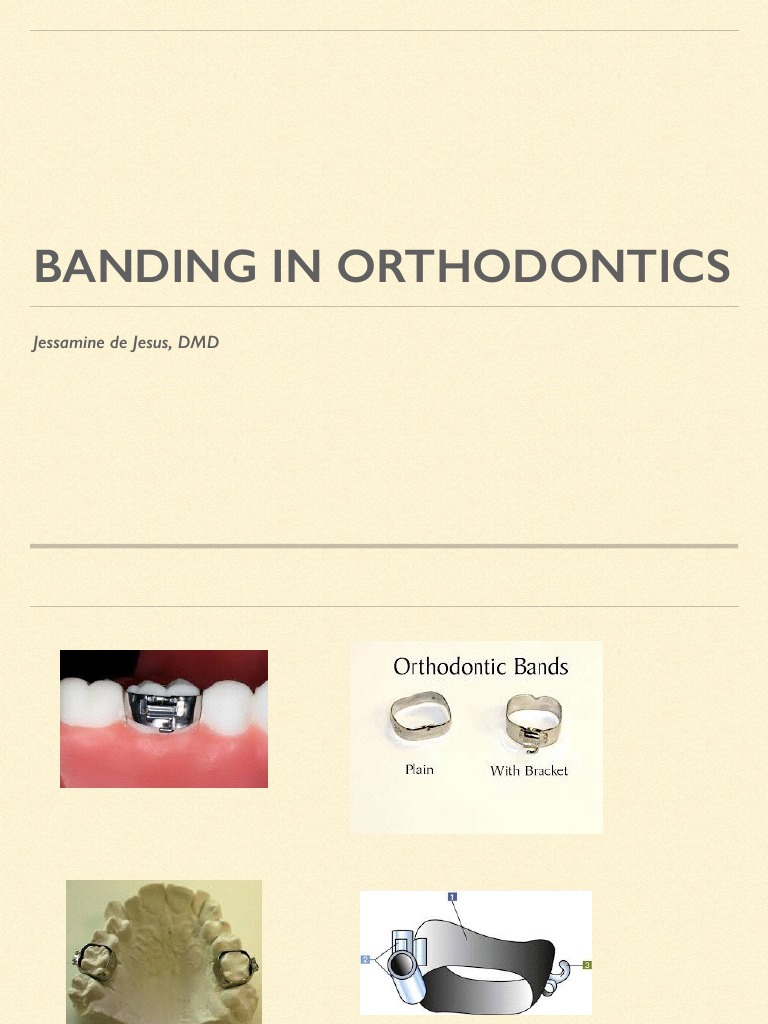 Banding in Orthodontics | PDF | Orthodontics | Human Tooth