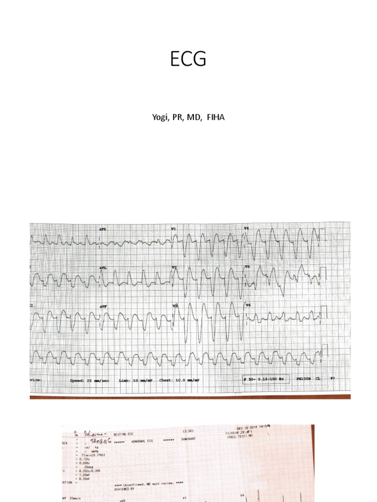 ECG Training | PDF